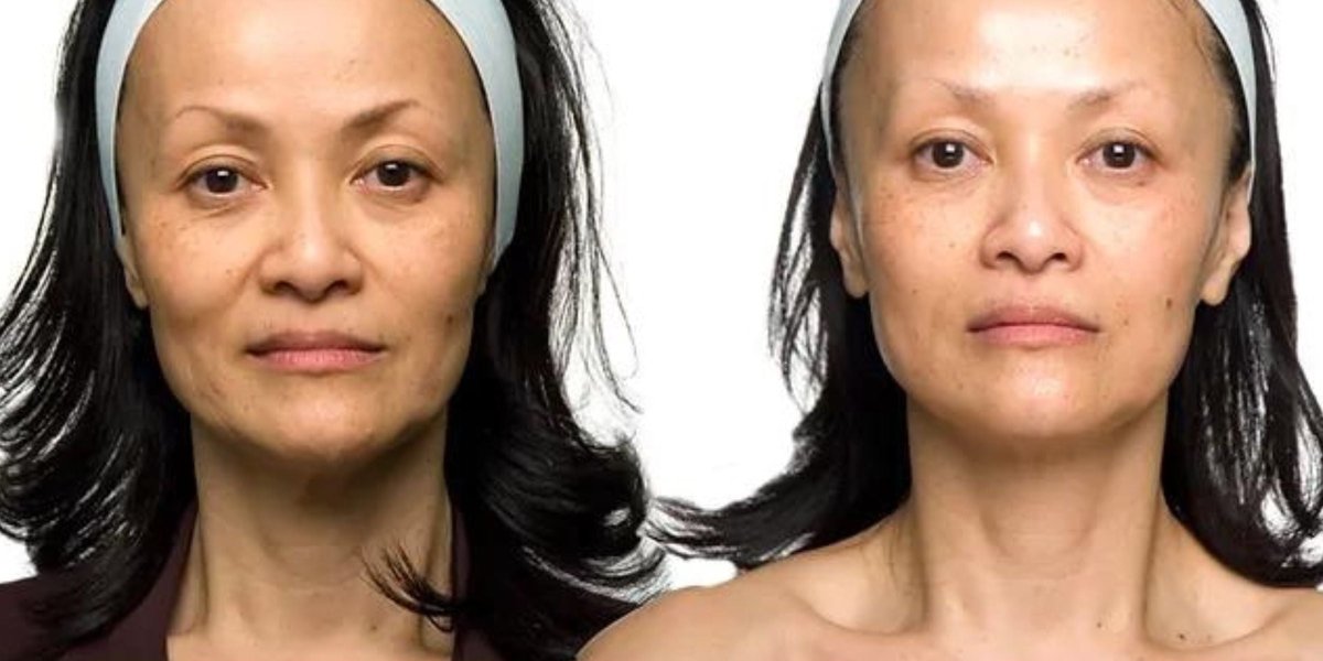 5 Things You Should Ask Before Buying an LED Face Mask – My Sheen Skin